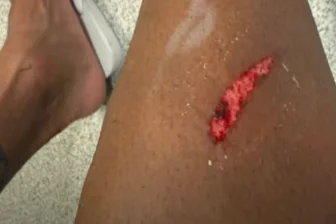 Memphis exibe perna machucada após Corinthians x Palmeiras